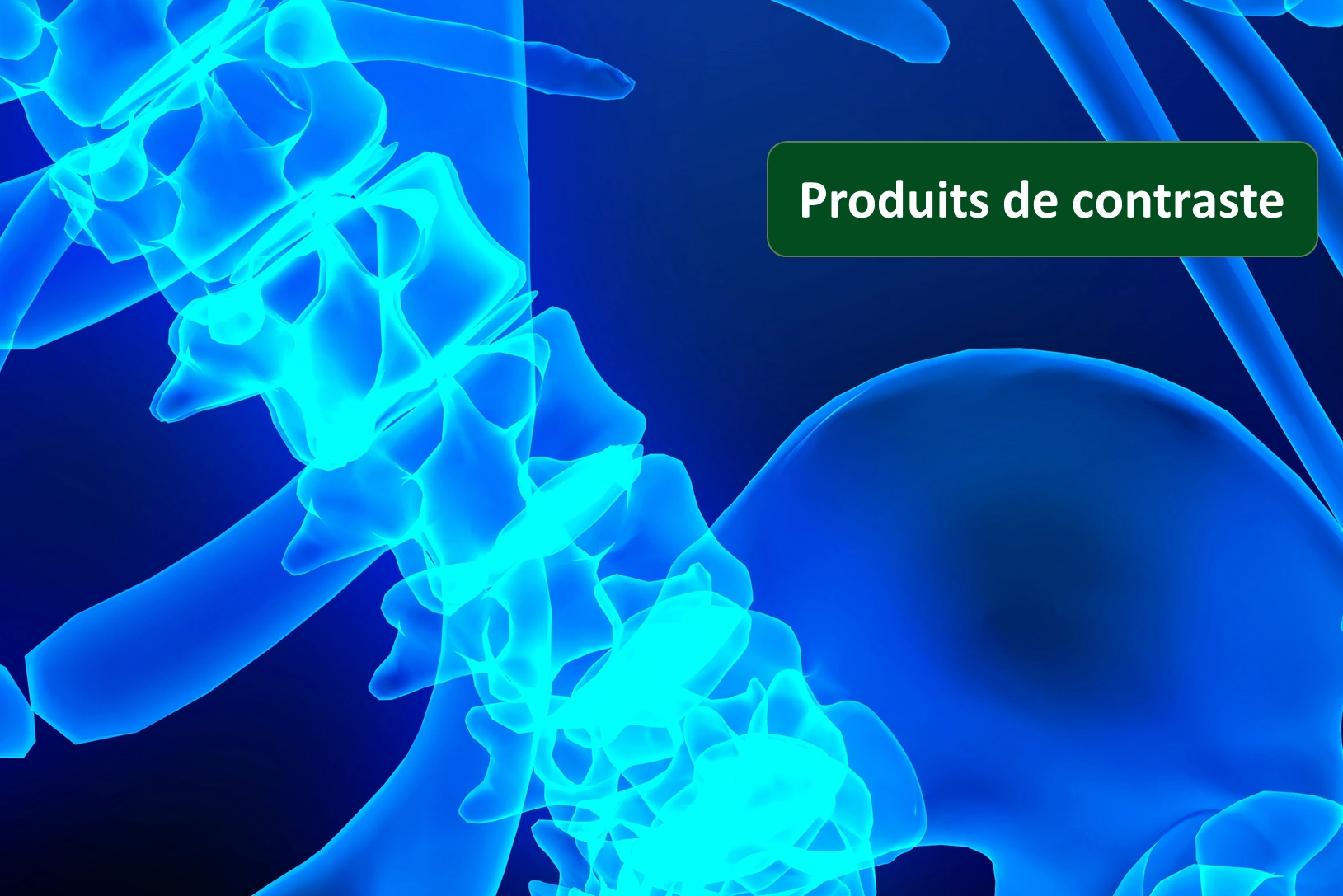Réduire son stock de produits de contraste - LEO Officine